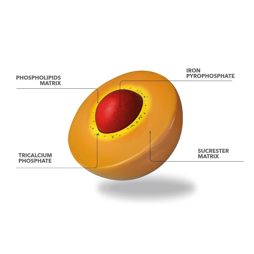 Iron deficiency in IBD, celiac disease and obesity - pharmanutra.it